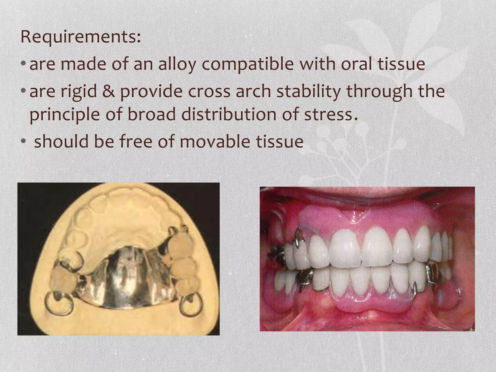 removable Partial denture | PPTX