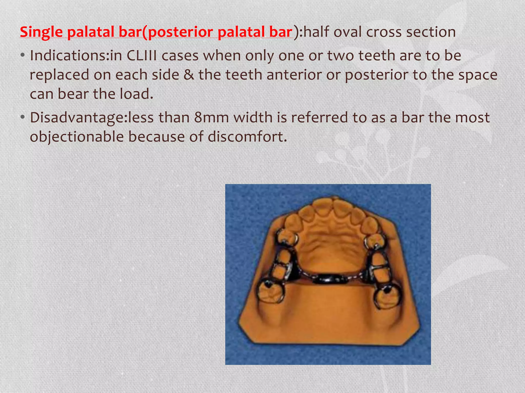 removable Partial denture | PPTX