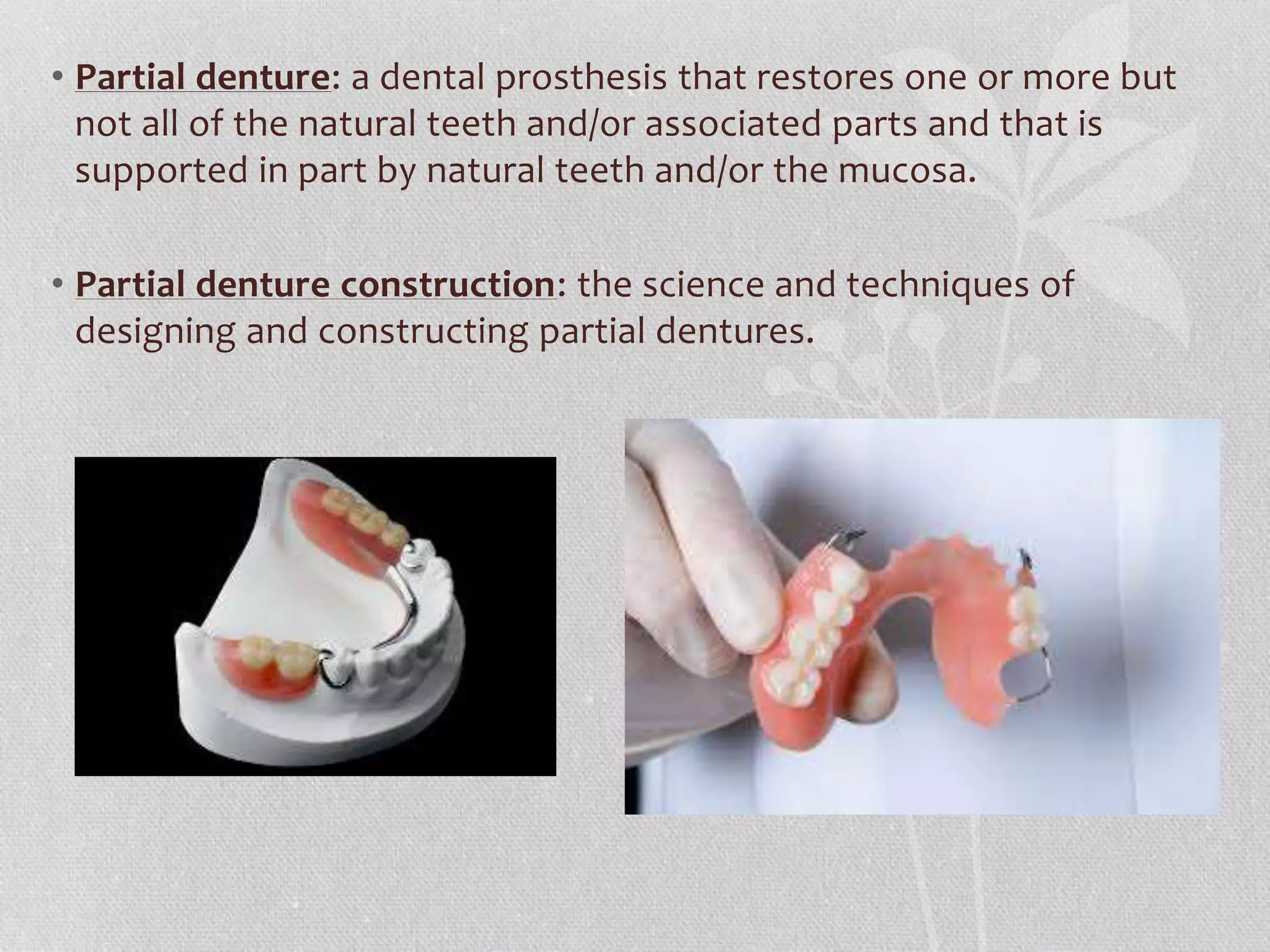 removable Partial denture | PPTX