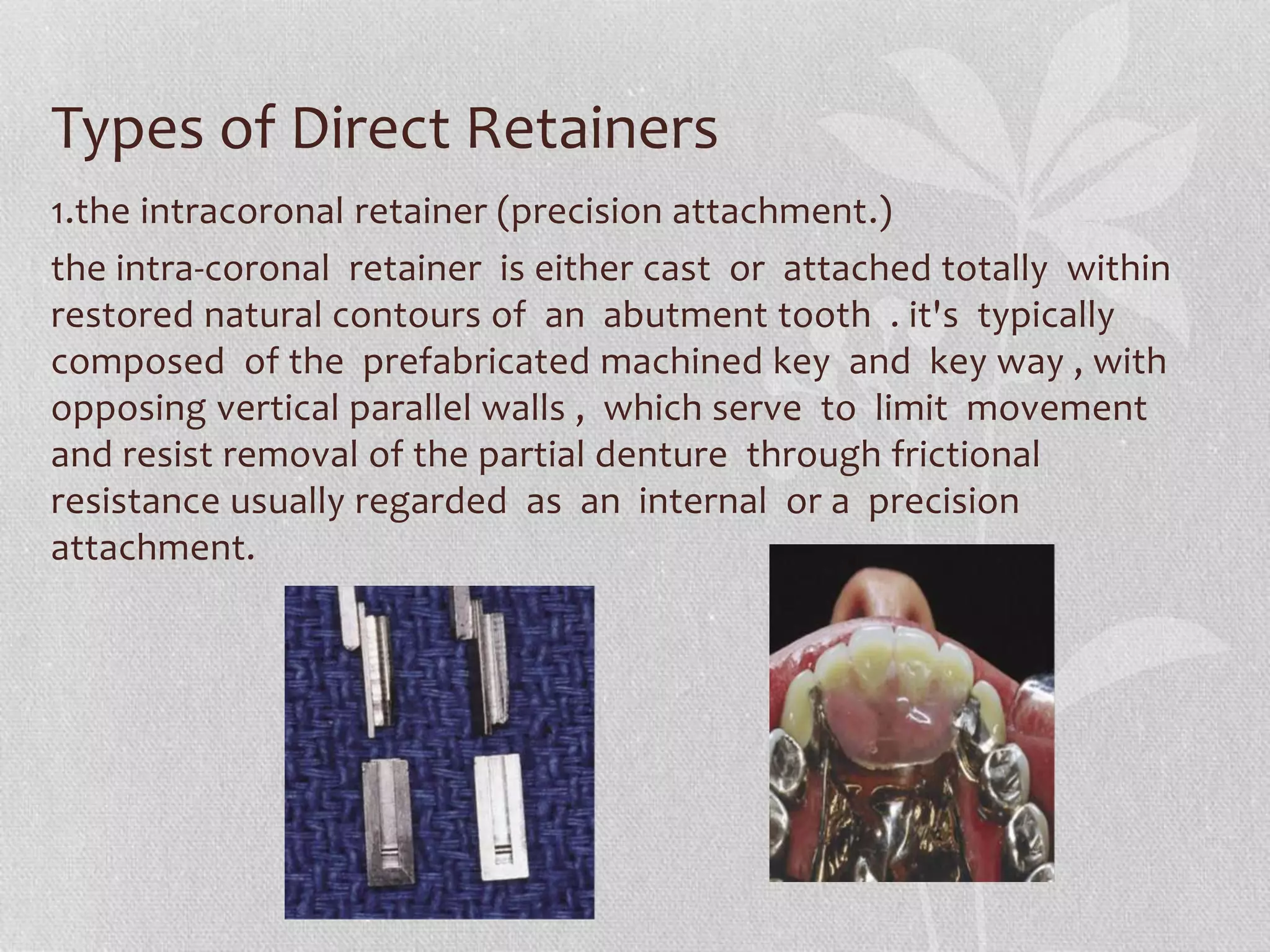 removable Partial denture | PPTX