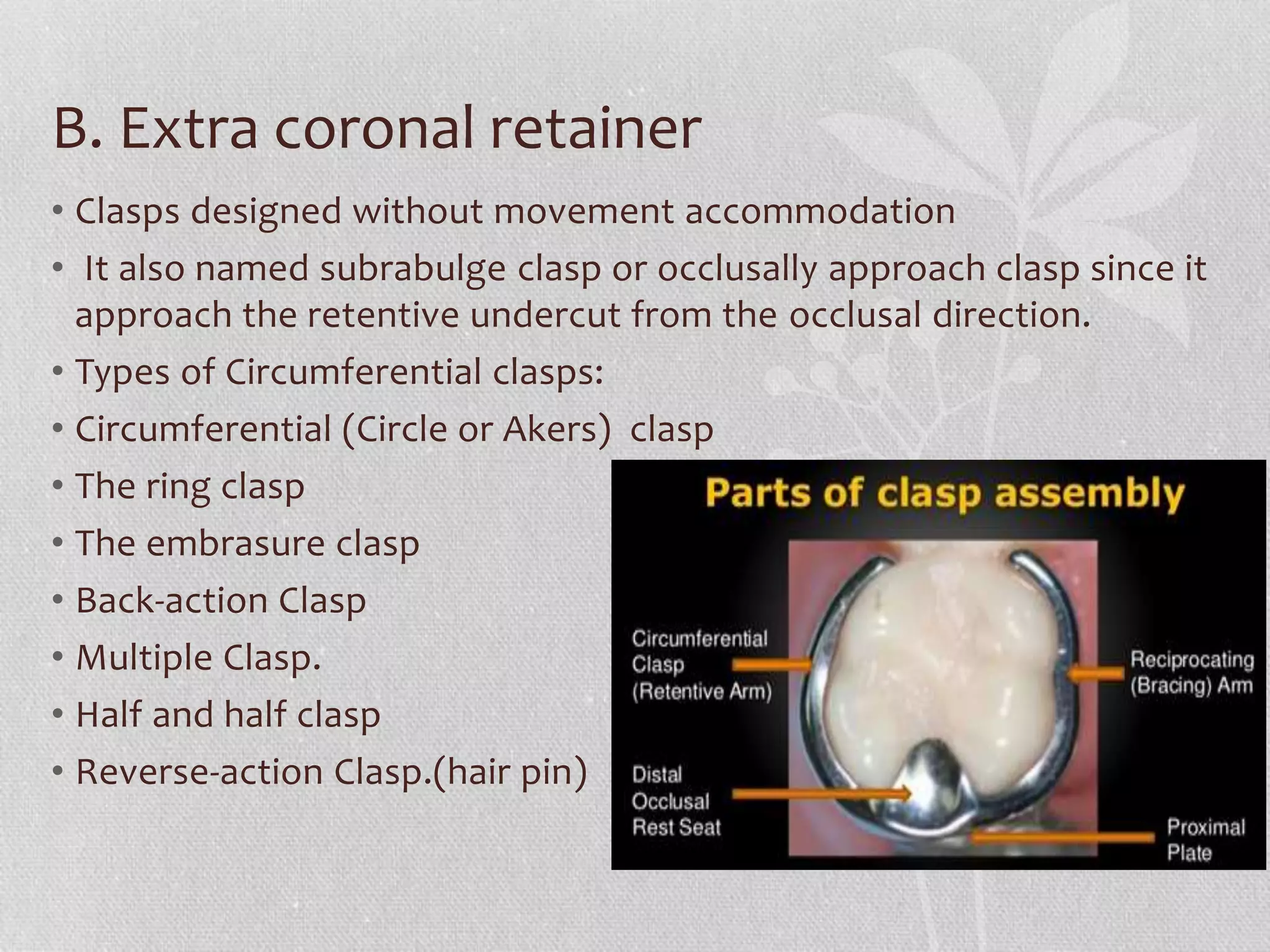 removable Partial denture | PPTX
