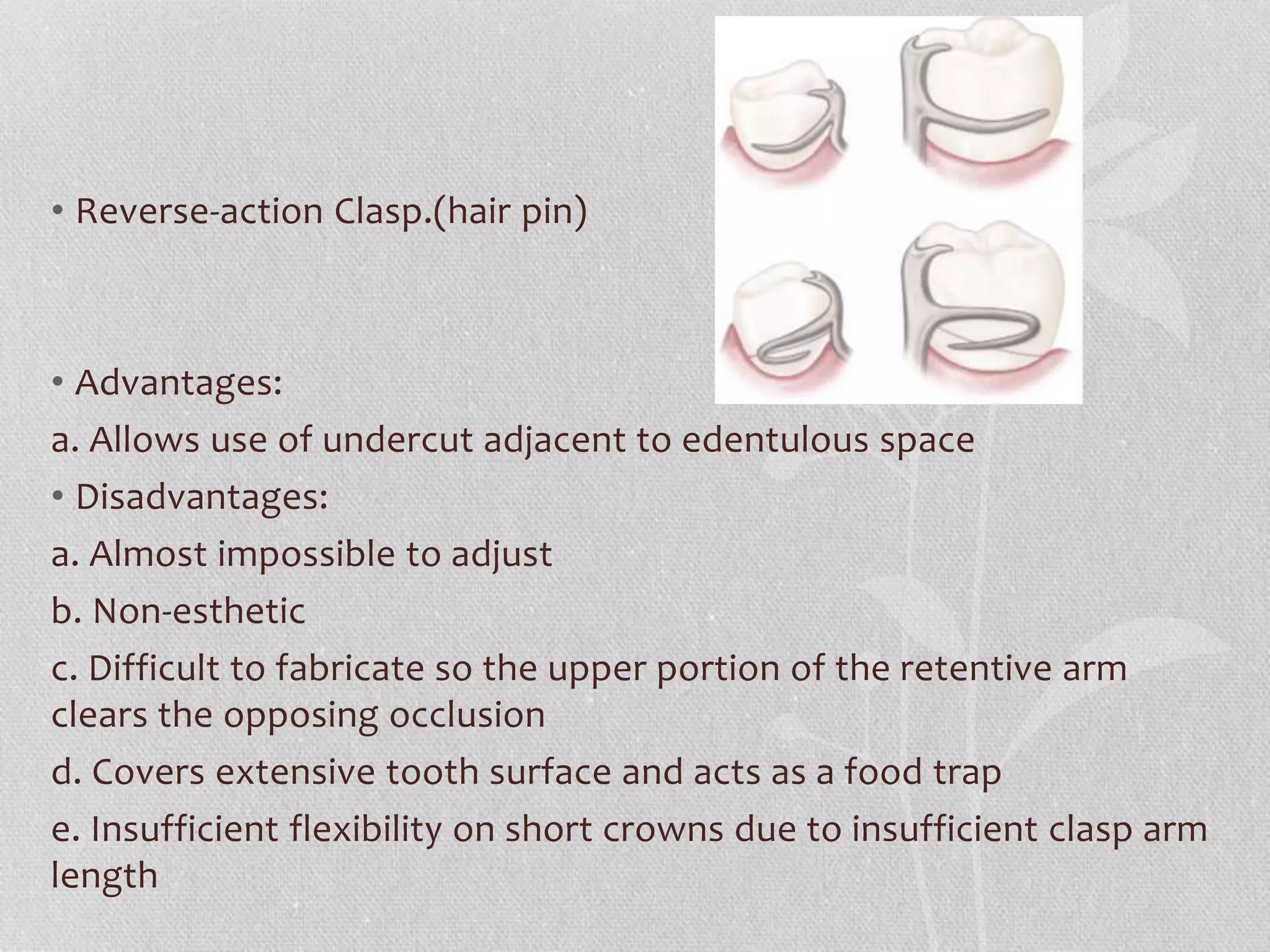removable Partial denture | PPTX