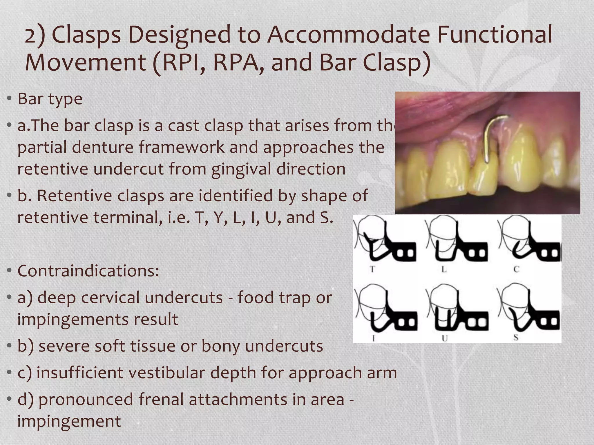 removable Partial denture | PPTX