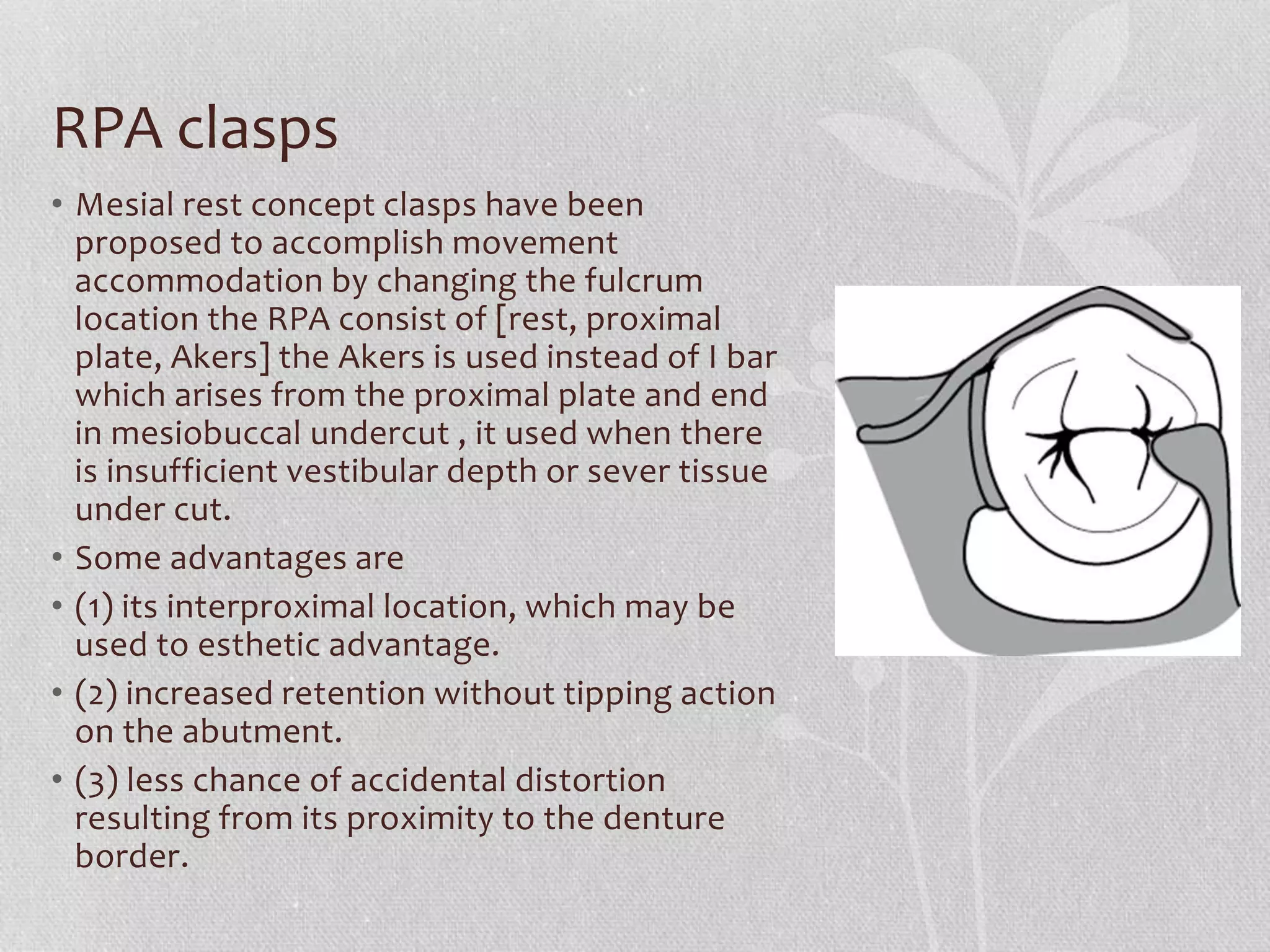 removable Partial denture | PPTX