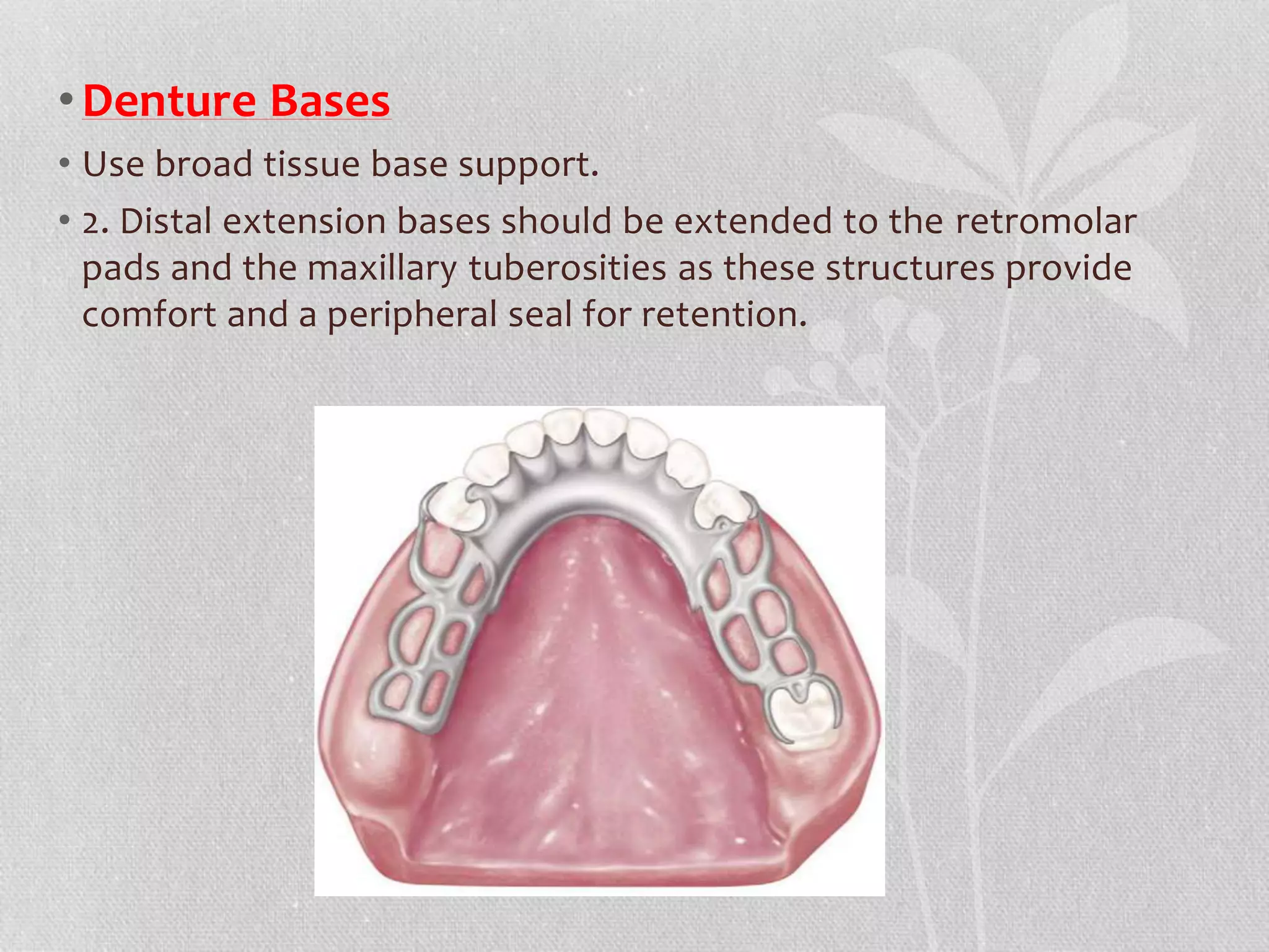 removable Partial denture | PPTX