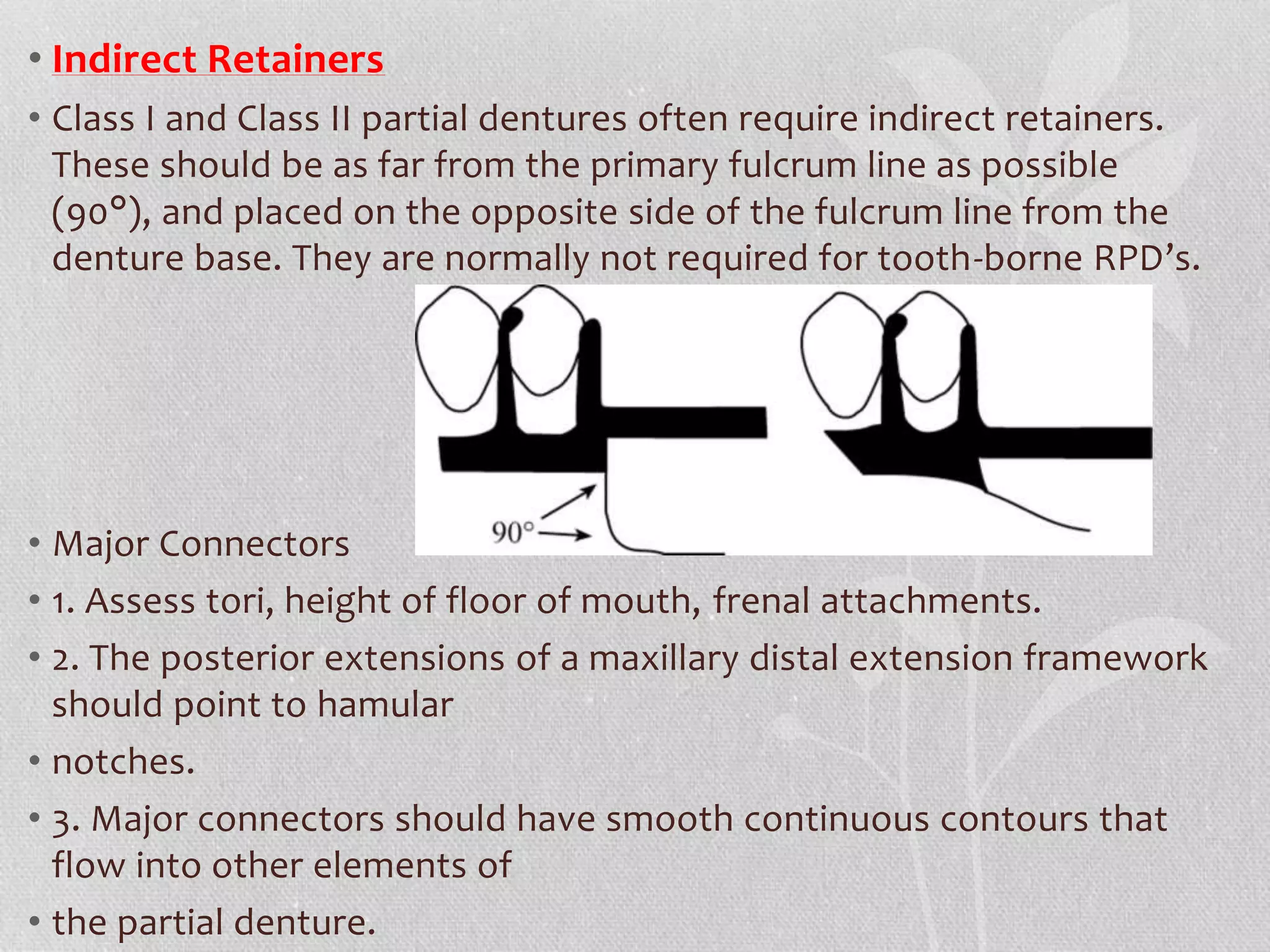 removable Partial denture | PPTX