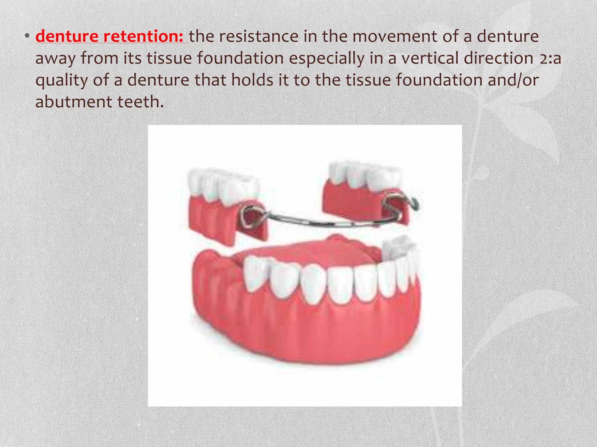 removable Partial denture | PPTX