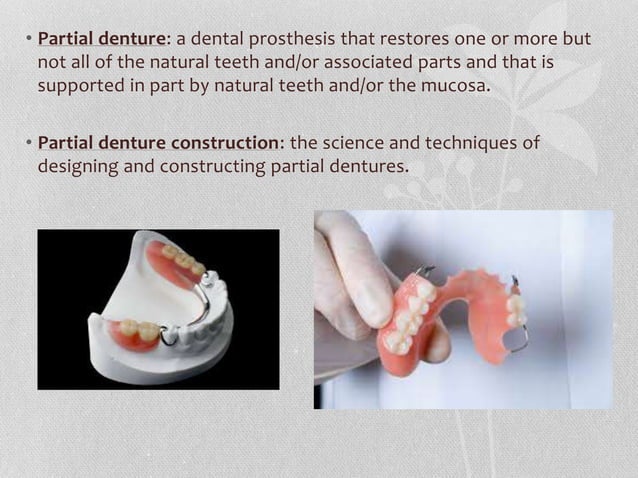 removable Partial denture | PPTX