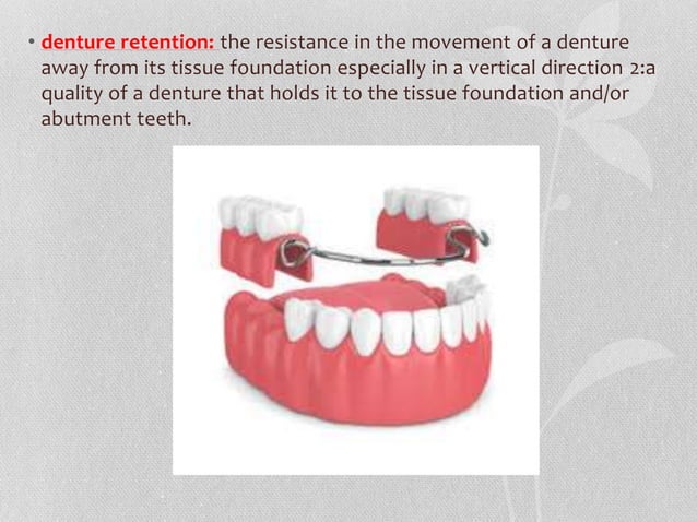 removable Partial denture | PPTX