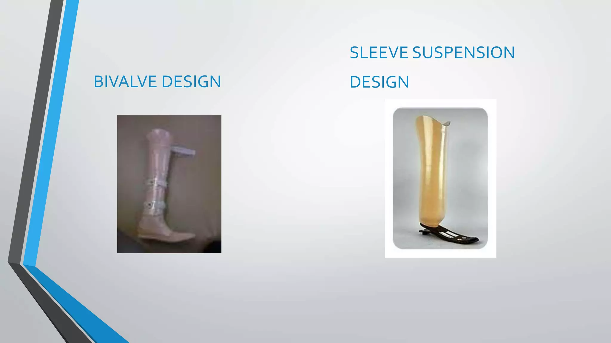 Prosthetic Management of Different Types of Partial Foot Amputation | PPTX