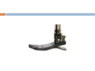 Partial foot prosthesis 1 | PPTX