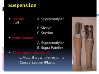 Partial foot prosthesis 1 | PPTX