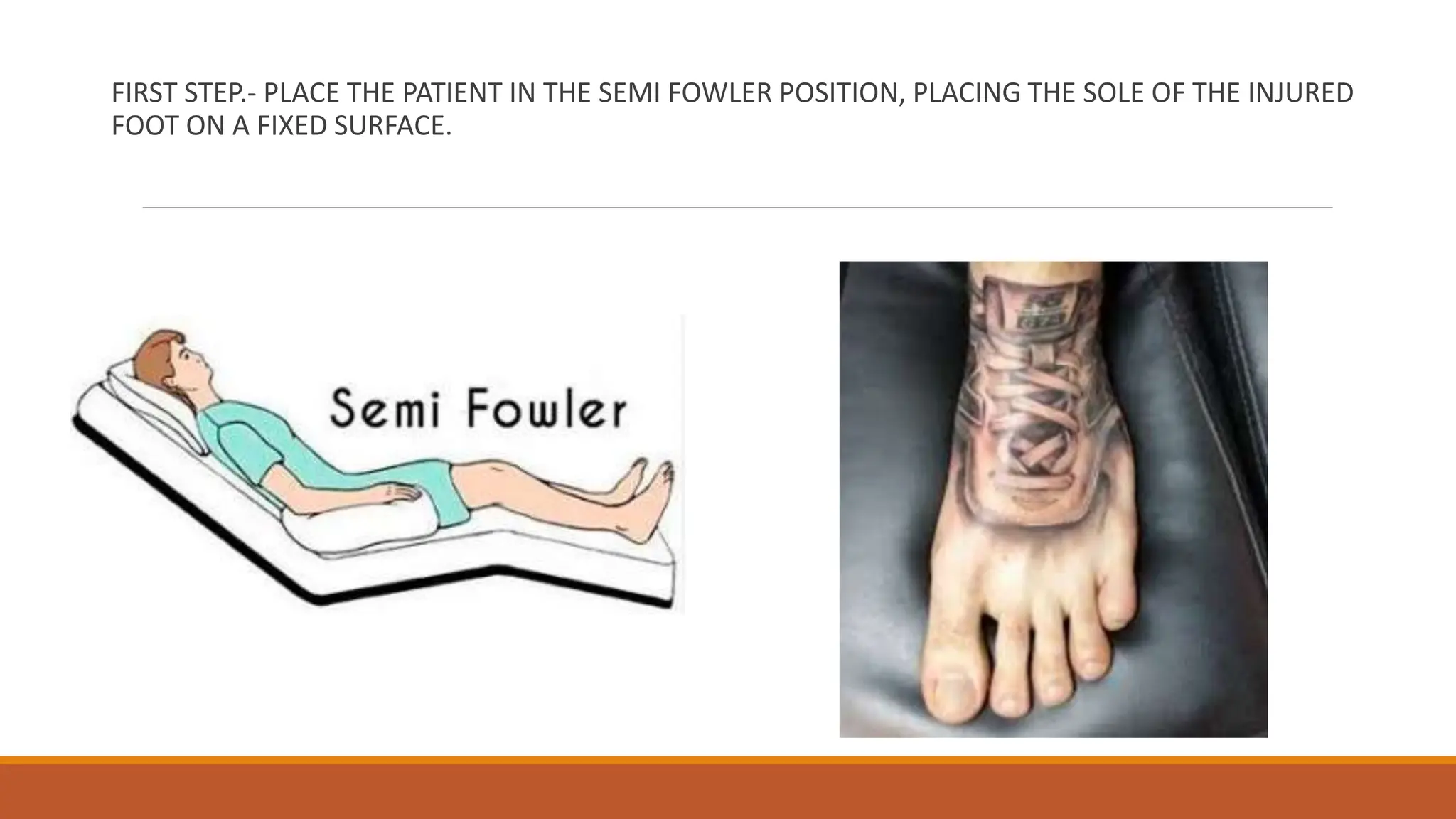 PARTIAL NAIL EXTRACTION PROCEDURE.pptx