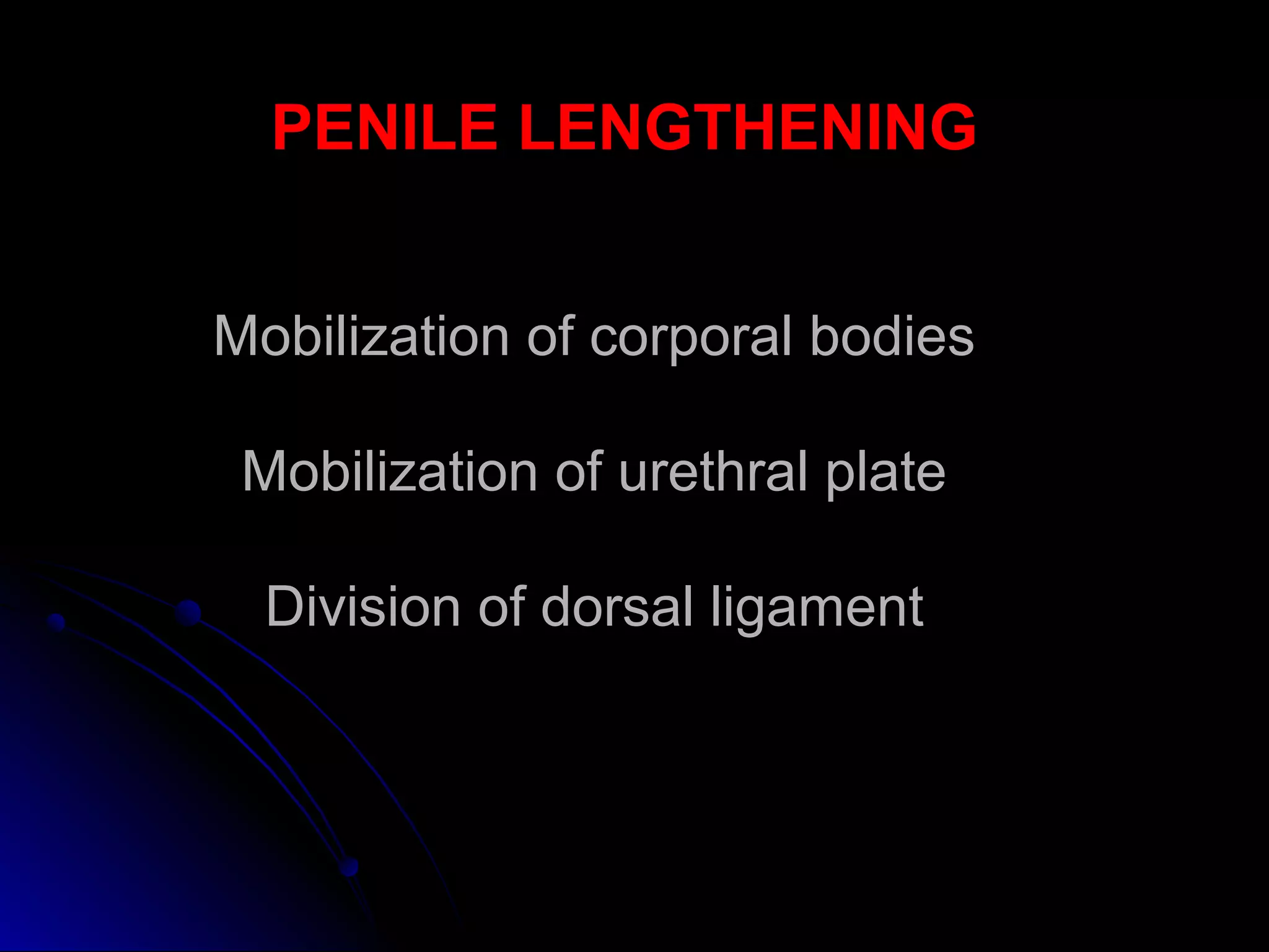 Partial penile disassembly for single stage repair of male epispadias | PPT
