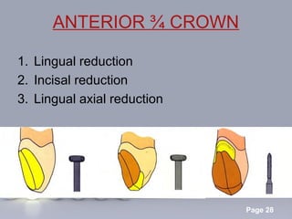 Dr Saransh Malot Partial veneer presentation preparation and ...