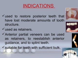 Dr Saransh Malot Partial veneer presentation preparation and ...