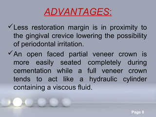 Dr Saransh Malot Partial veneer presentation preparation and ...