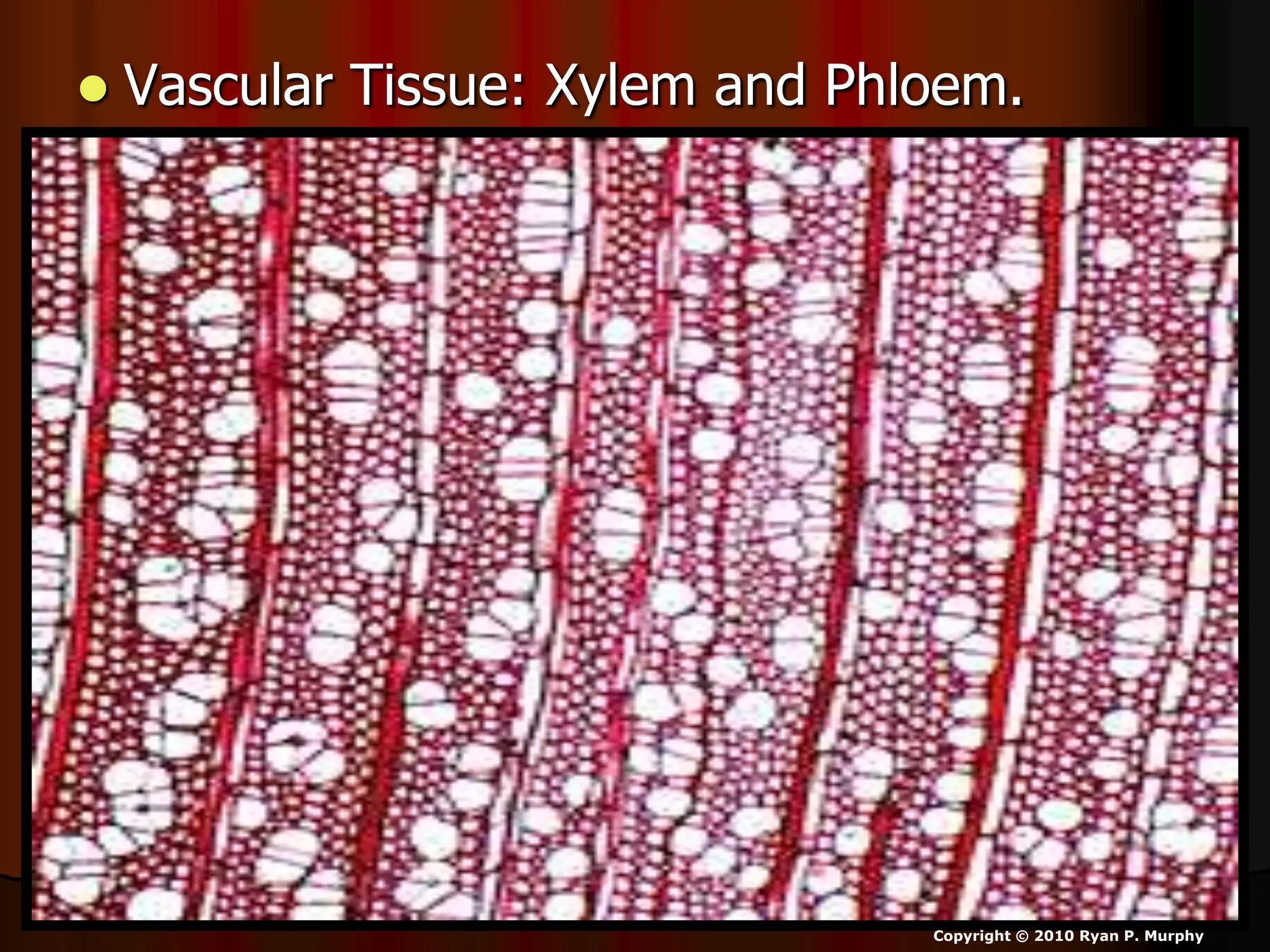 Plant Tissues, Woody Plants, Xylem, Phloem, Dendrochronolgy Biology ...