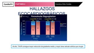 PARTNER 3 Trial | PDF