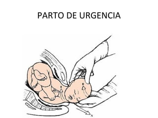 Parto | PPT