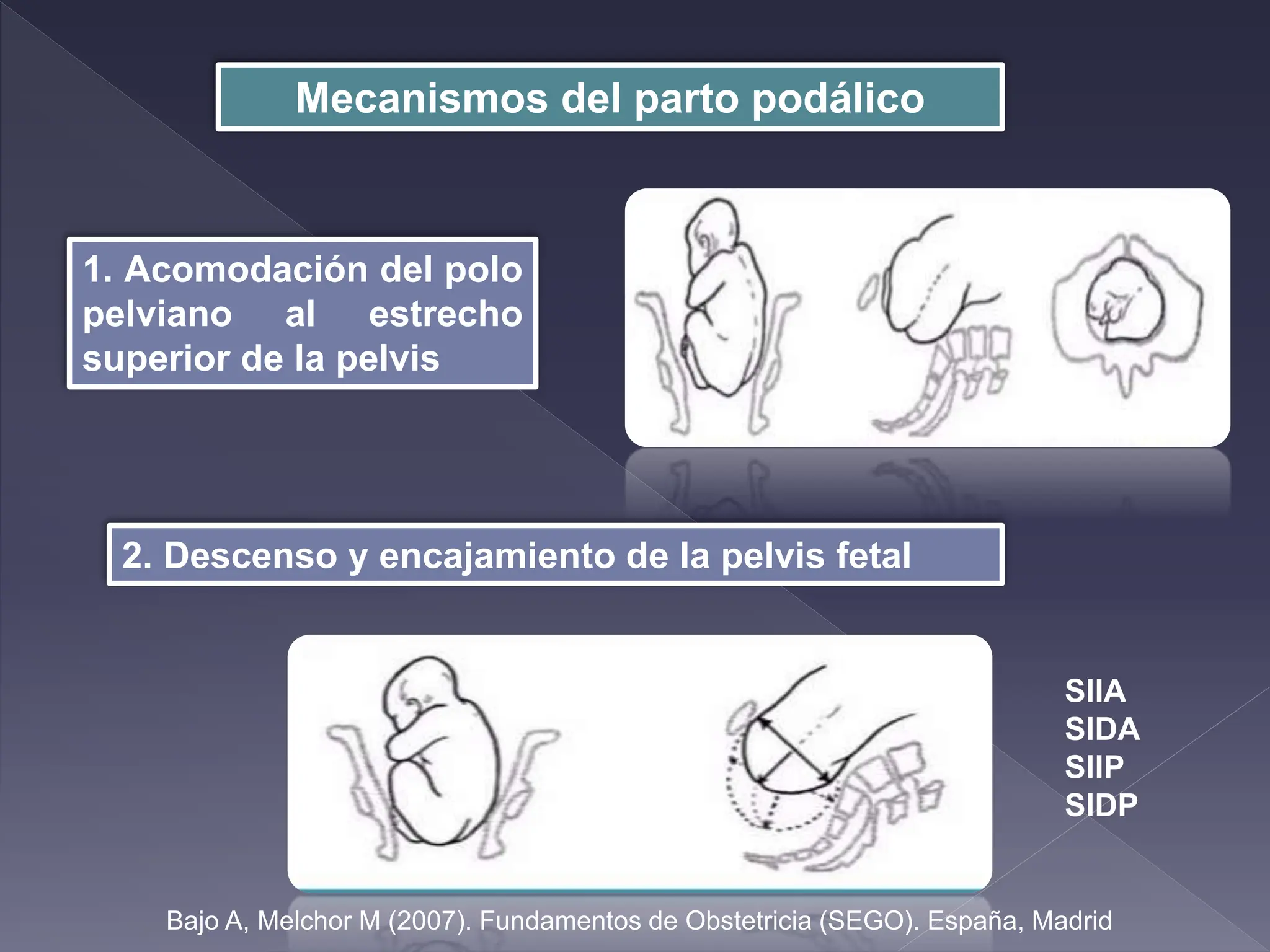 Mecanismo del parto podalico segun la presentación podalica | PPTX