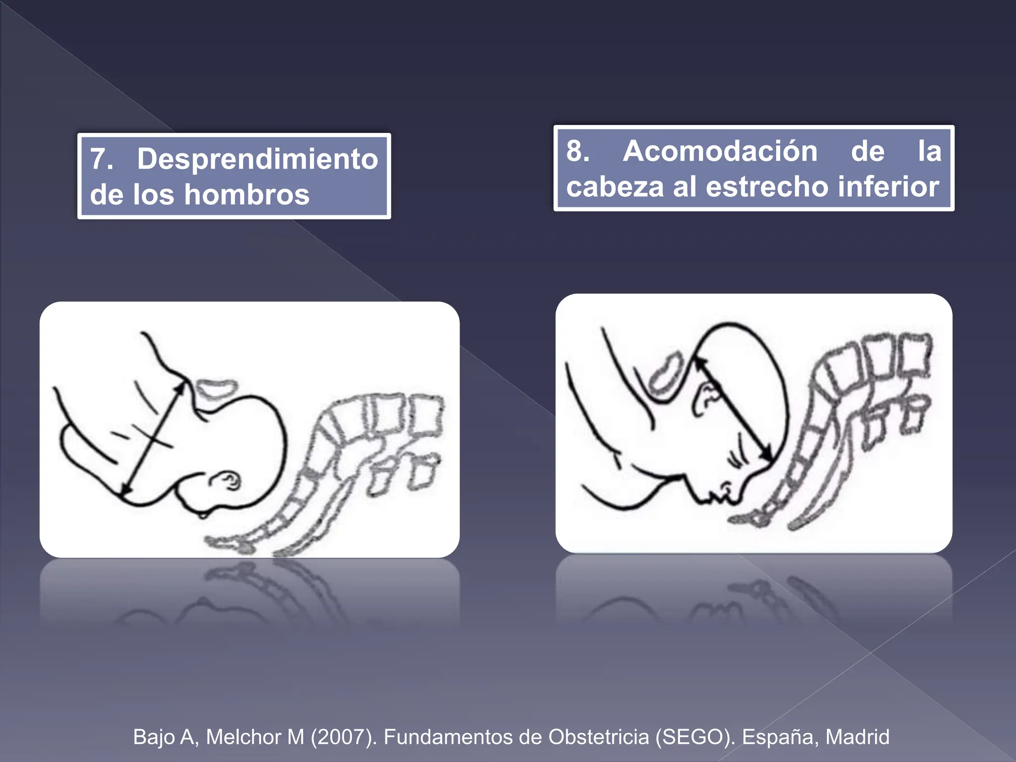 Mecanismo del parto podalico segun la presentación podalica | PPTX