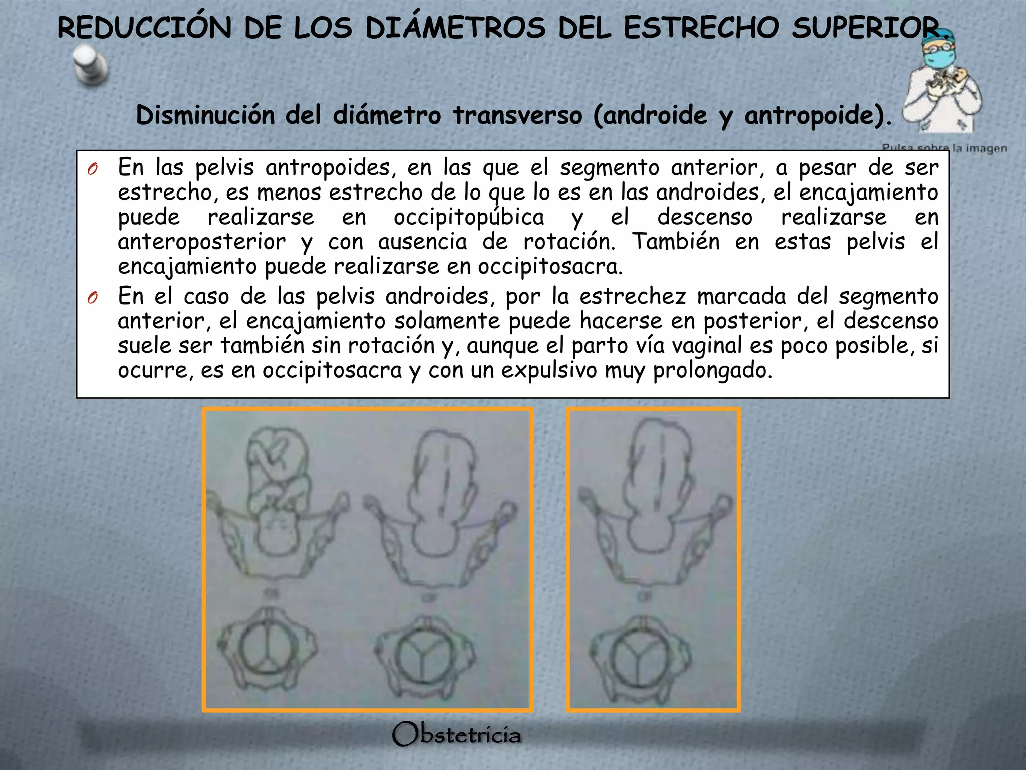 Parto En Diferentes Tipos De Pelvis Ppt