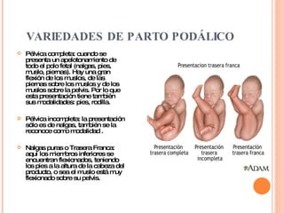 Parto En Podalica | PPT
