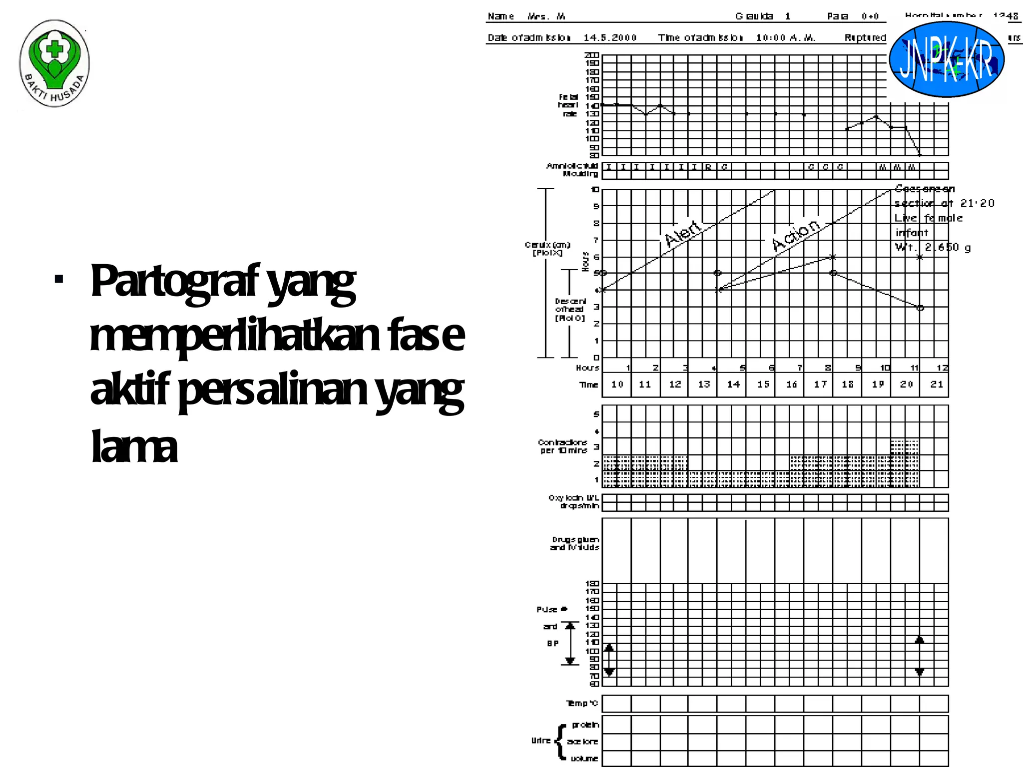Partograf-1.pdf penggunaan partograf dan cara | PPT