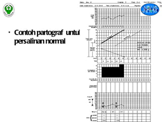 Partograf-1.pdf penggunaan partograf dan cara | PPT