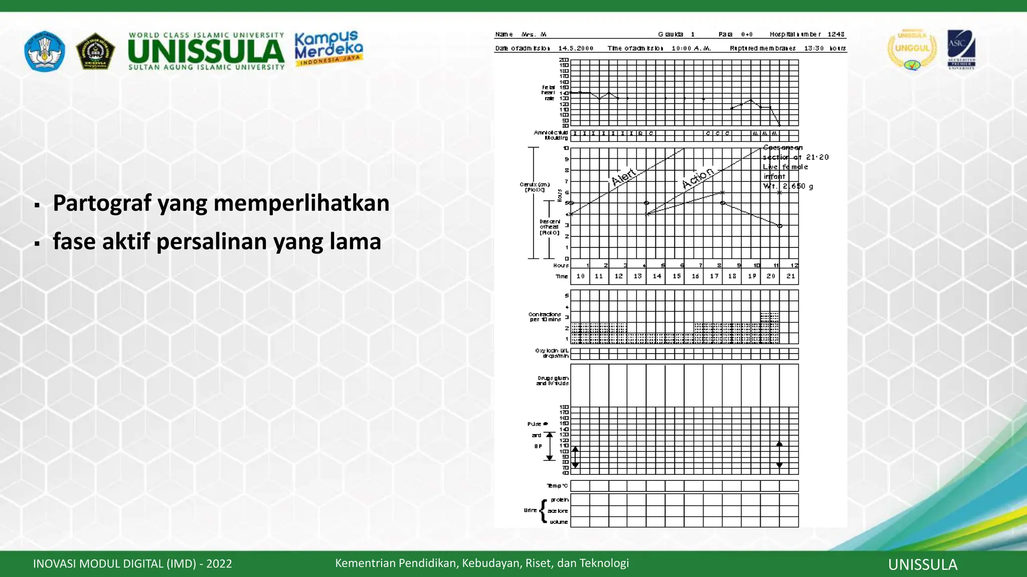 partograf. pencatatan proses kelahiran.ppt