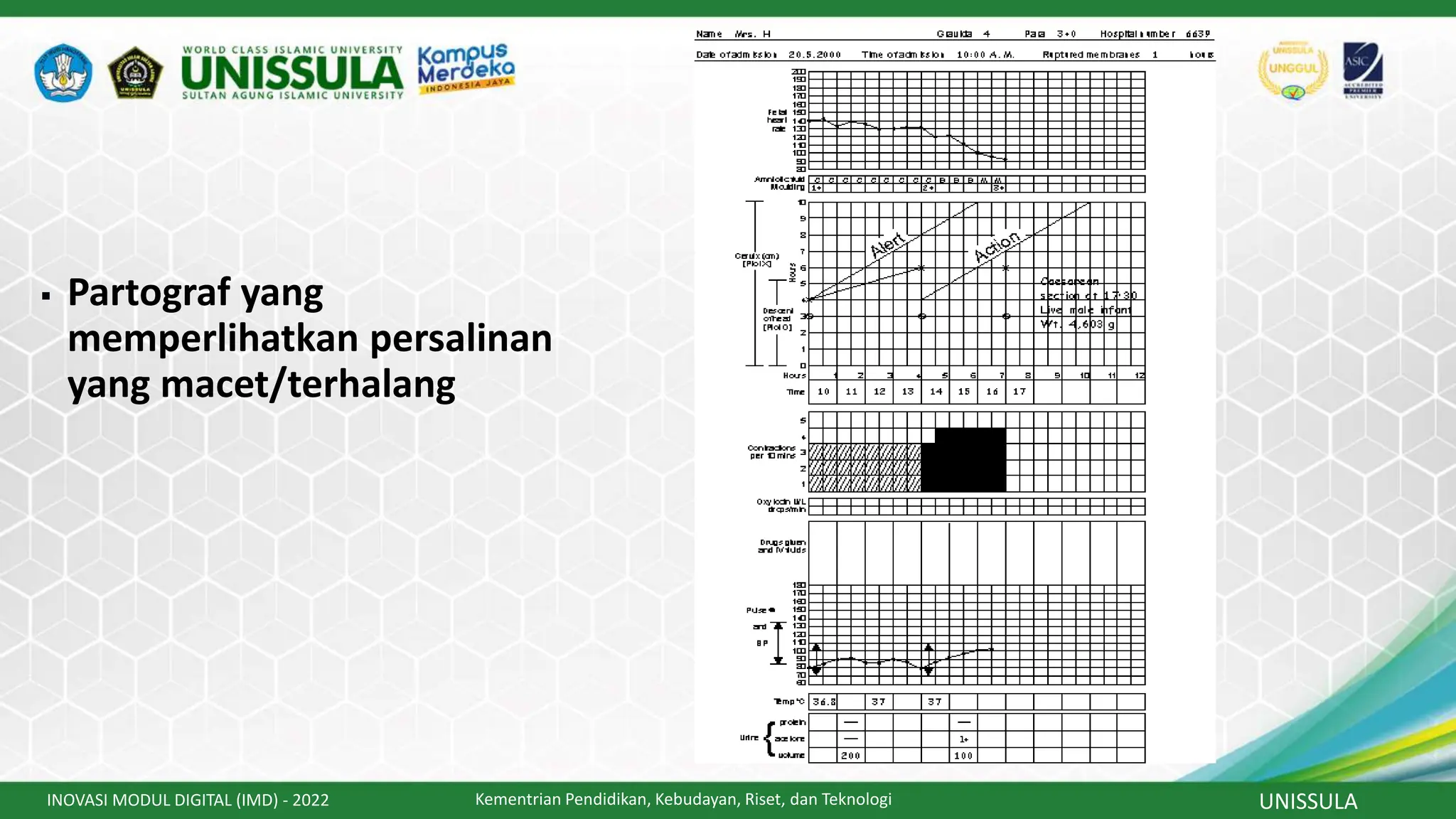 partograf. pencatatan proses kelahiran.ppt