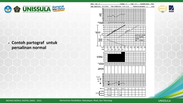 partograf. pencatatan proses kelahiran.ppt