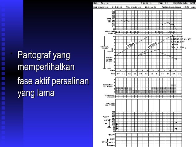 penjelasan tentang Partograf pada Persalinan | PPT