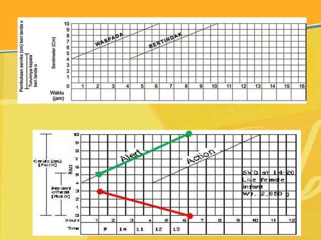 Partograf dan penilaian kemajuan persalinan | PPTX
