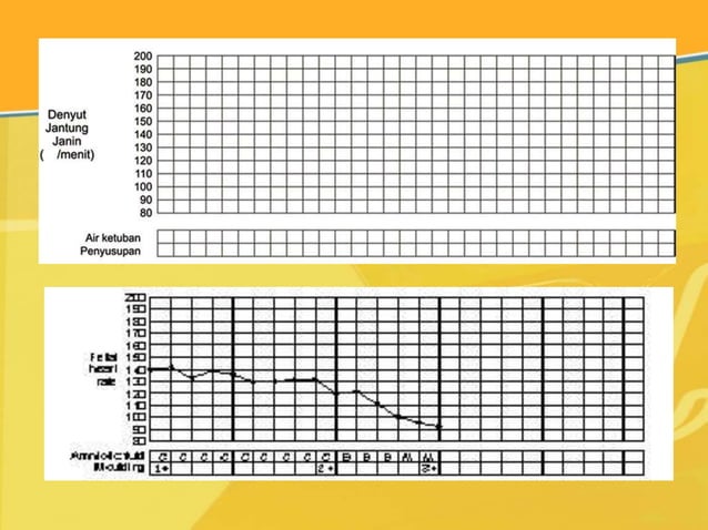 Partograf dan penilaian kemajuan persalinan | PPTX