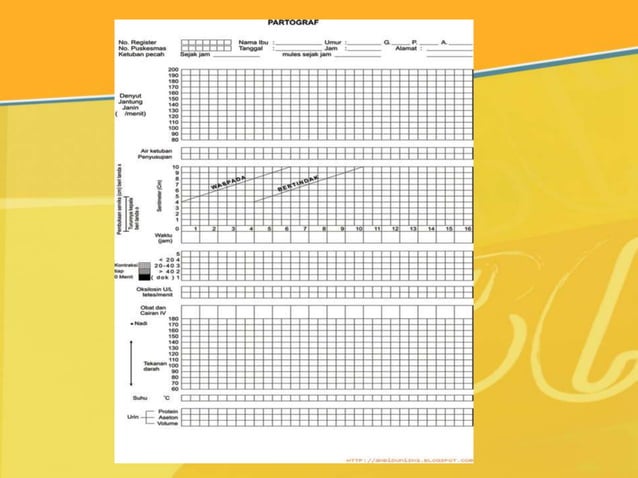 Partograf dan penilaian kemajuan persalinan | PPTX