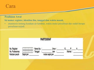 Partograf dan penilaian kemajuan persalinan | PPTX