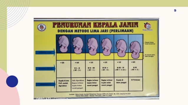cara pengisian PARTOGRAF (persalinan) PPT.pptx