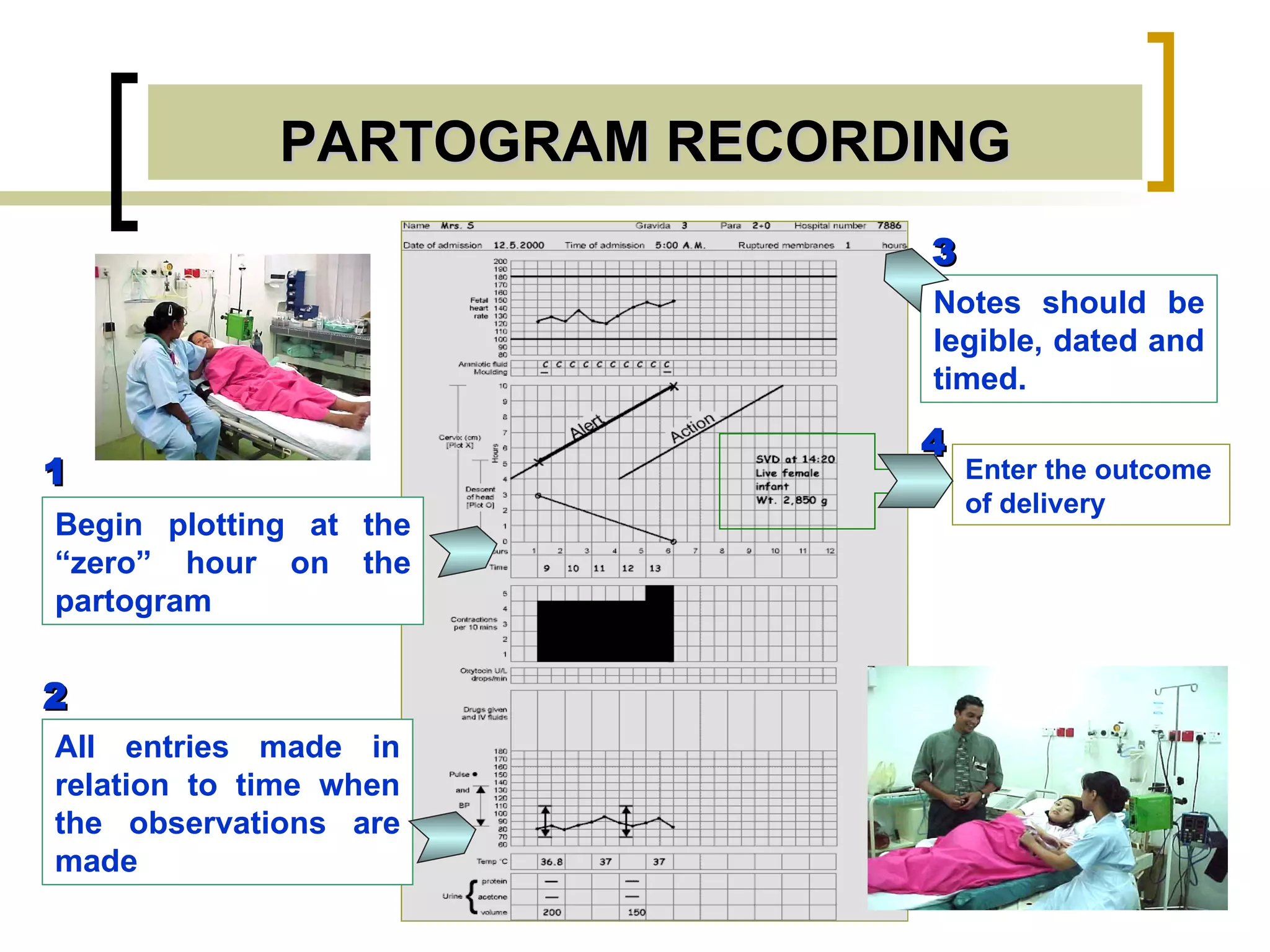 Partogram | PPT