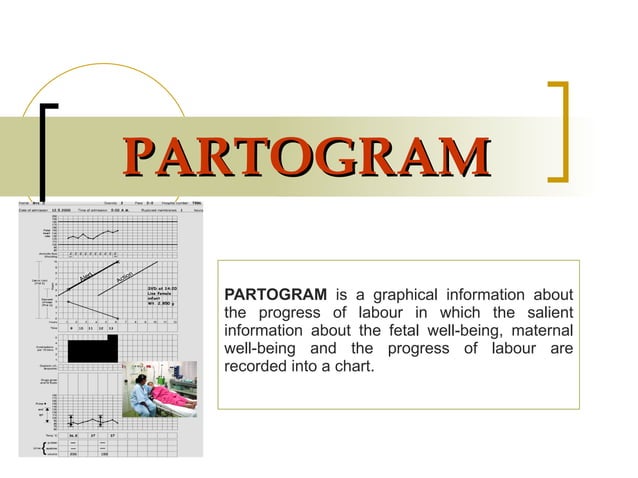 Partogram | PPT