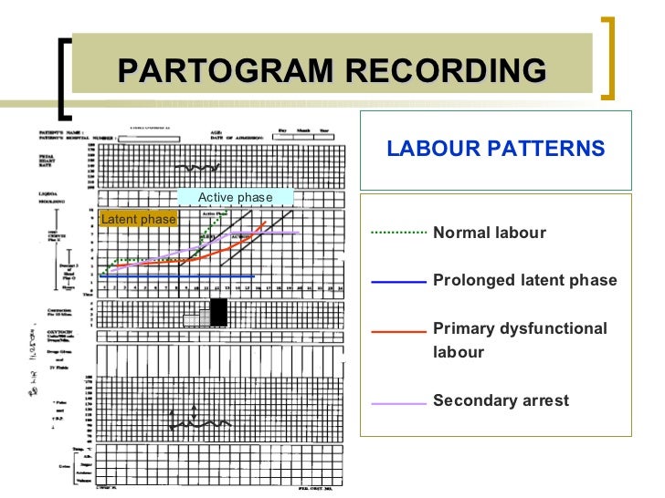 Partogram