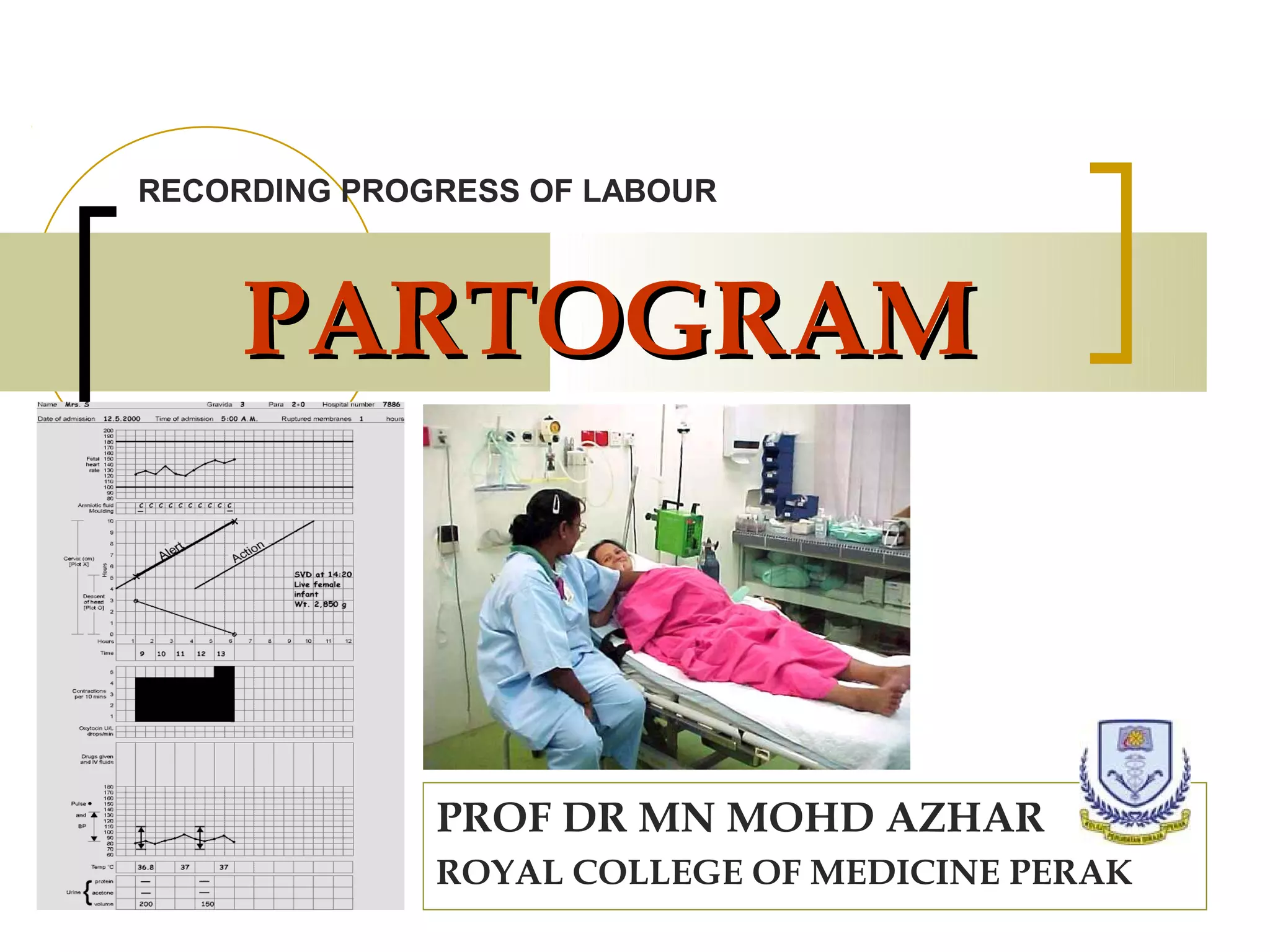 Partogram | PPT