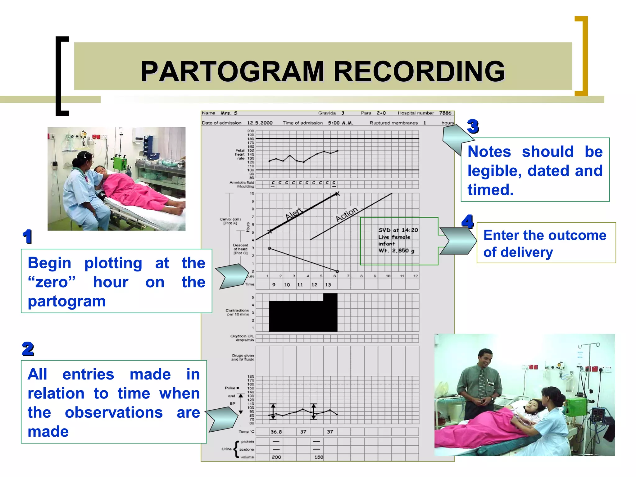 Partogram | PPT