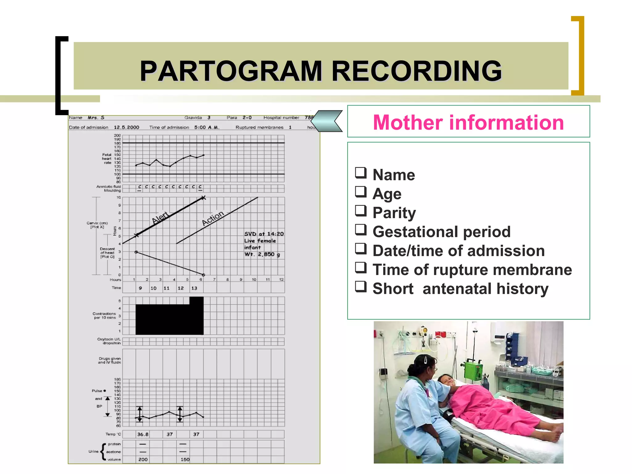 Partogram | PPT
