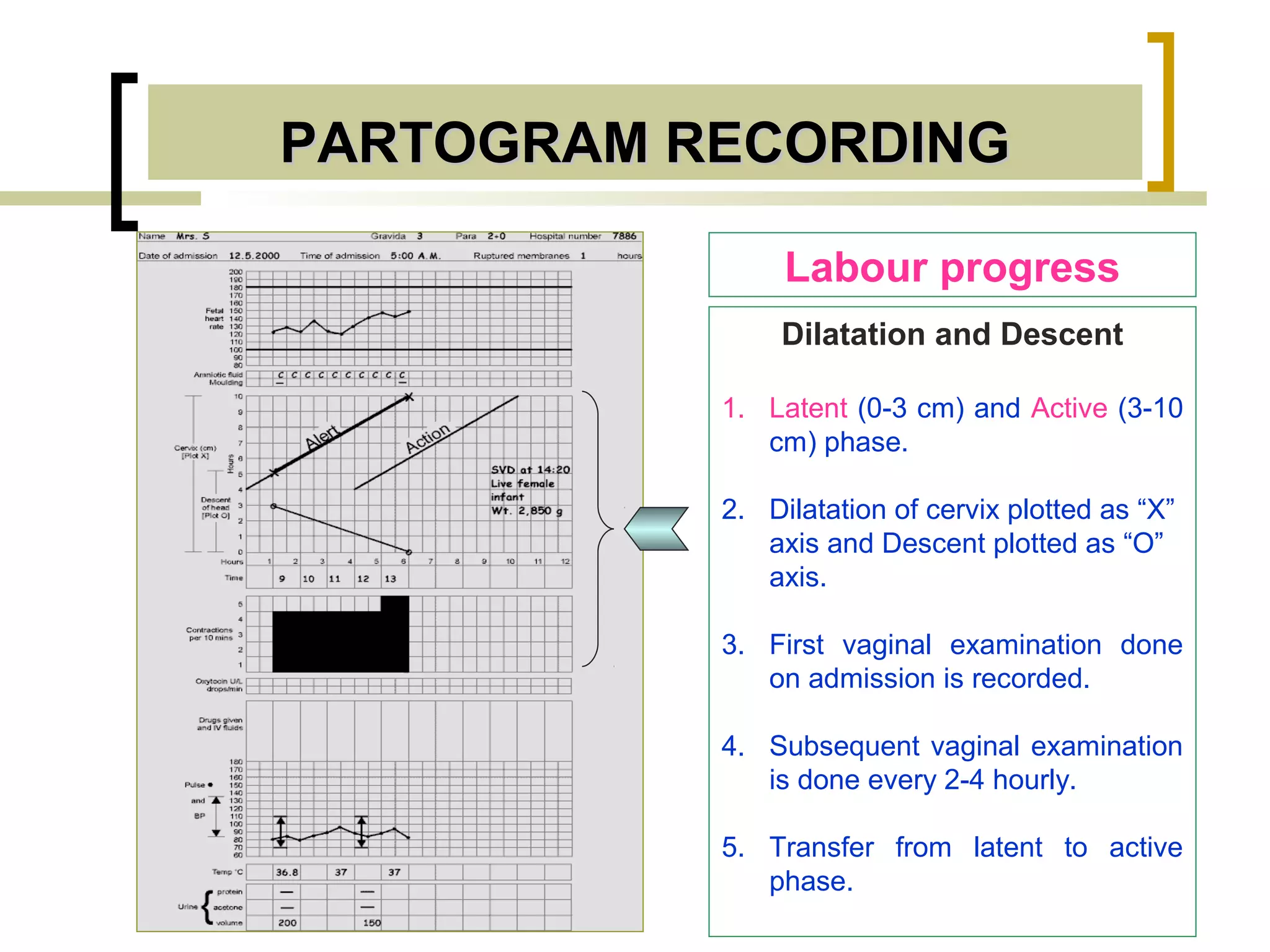 Partogram | PPT
