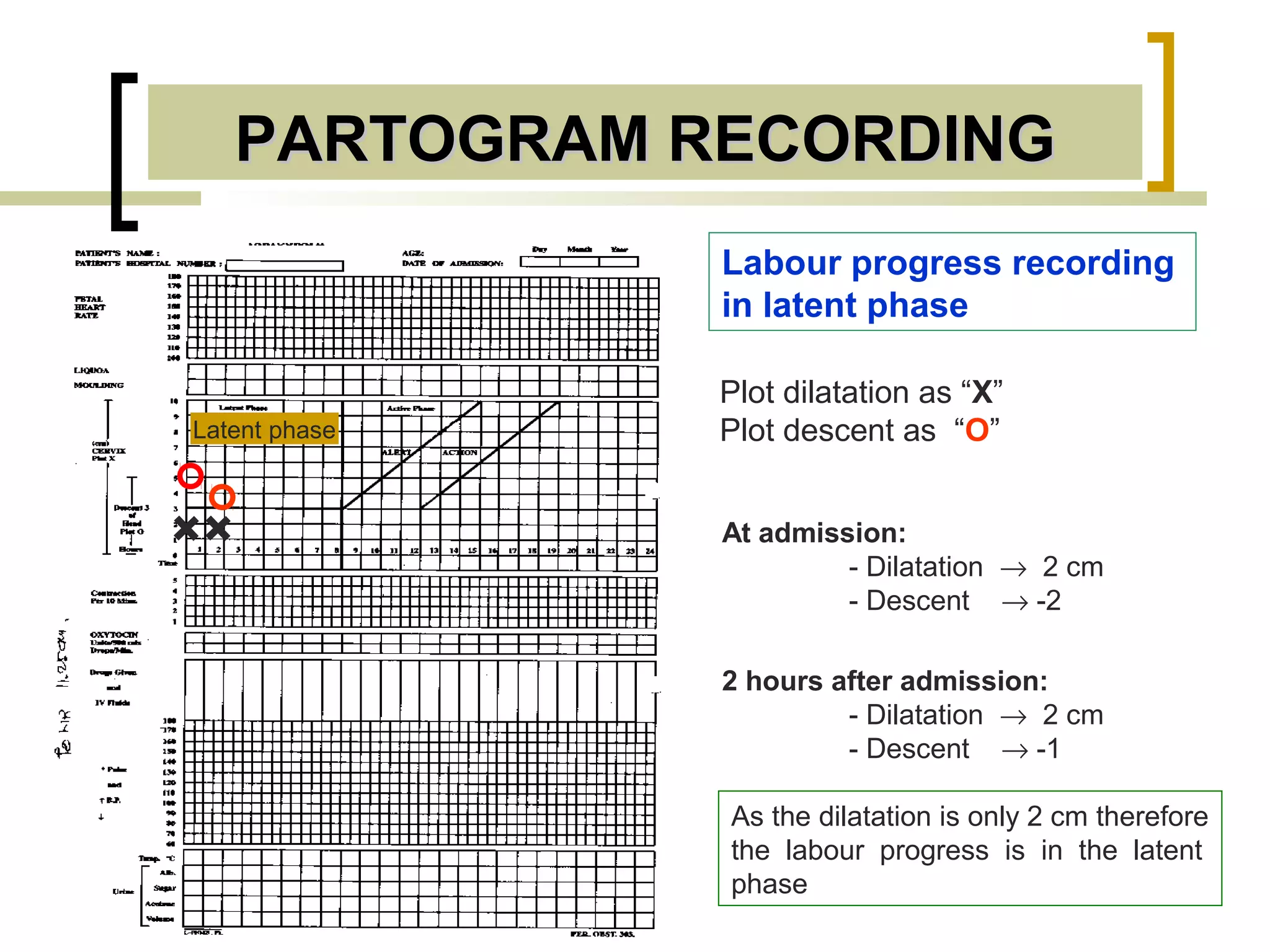 Partogram | PPT