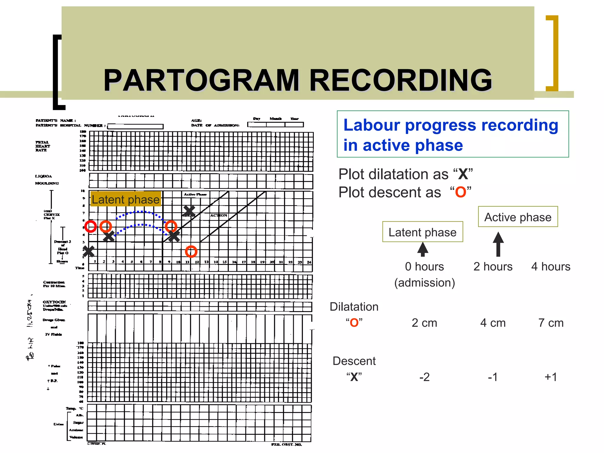 Partogram | PPT | Pregnancy | Reproductive Health