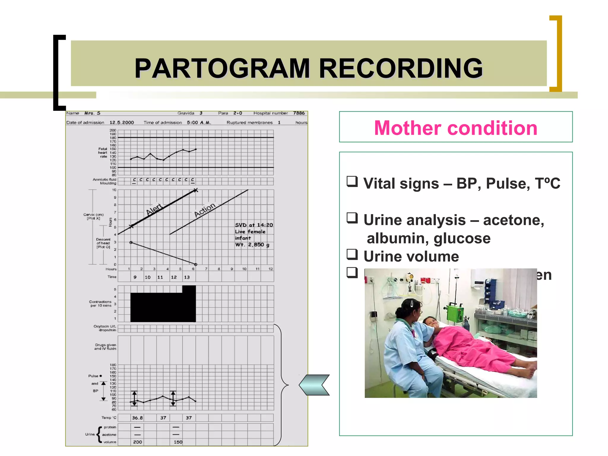 Partogram | PPT