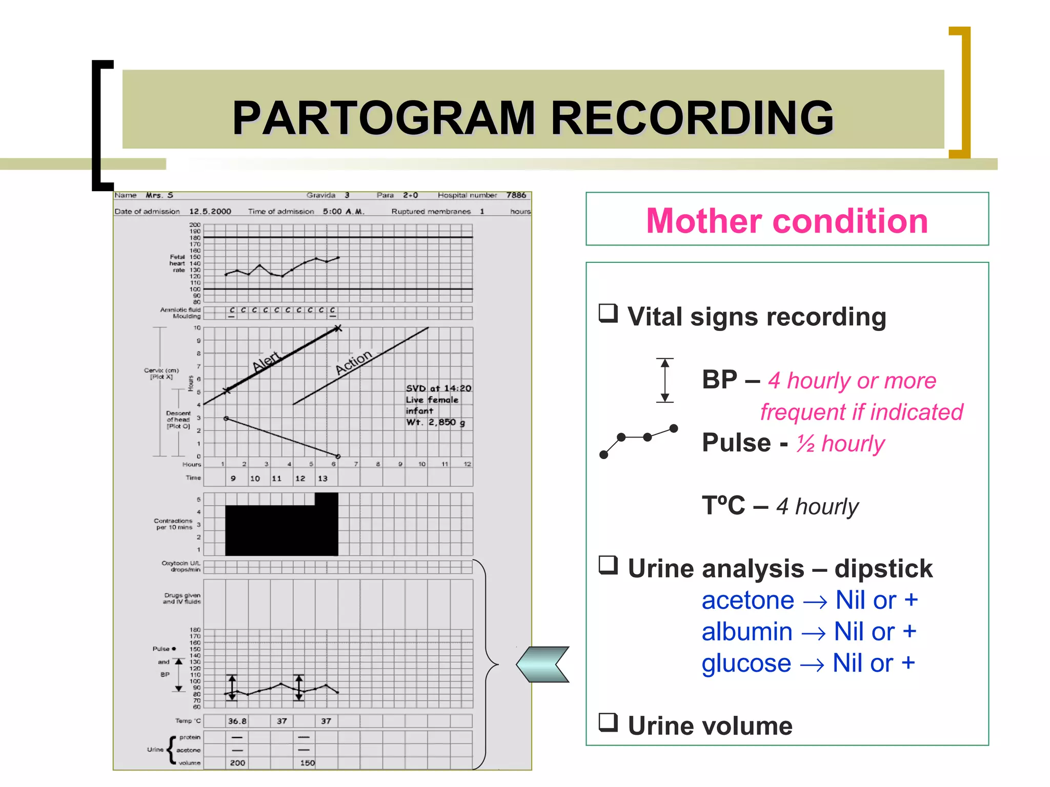 Partogram | PPT